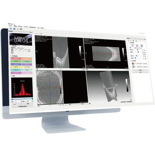 Aid software - MIPA - Suzhou Big Vision Medical Technology - ophthalmology