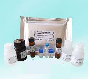 Gamma-glutamyl transferase test kit - 00028996 - Covalab SAS - for ...
