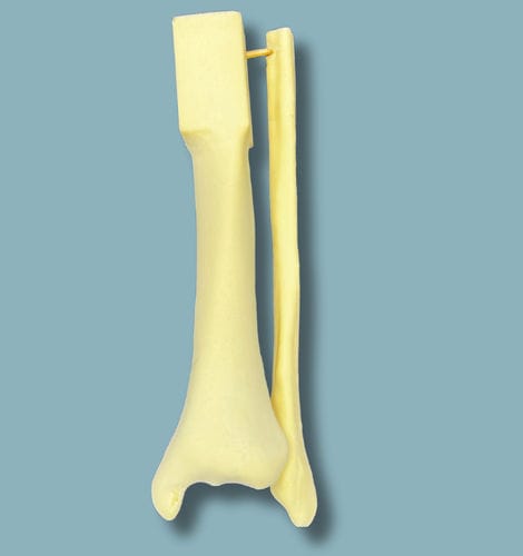 Tibia anatomical model - 03-20-01 - ADDIDREAM - fibula / surgery / training
