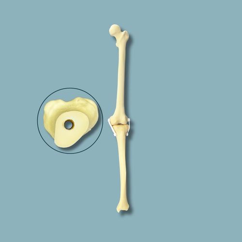Knee model - 04-31-01 - ADDIDREAM - bone / surgery / training