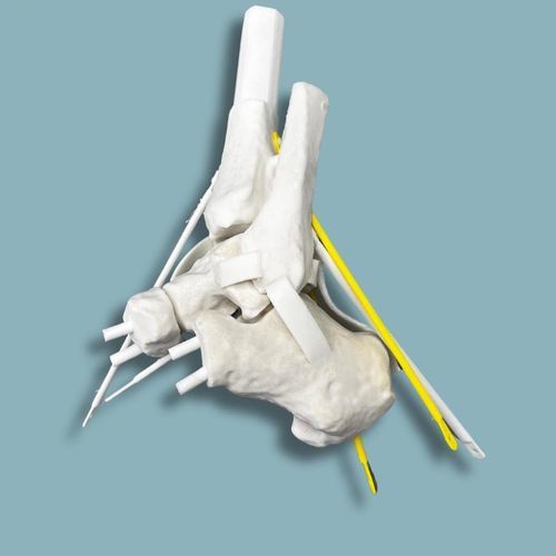 Ankle anatomical model - 02-04-02 - ADDIDREAM - surgery / arthroscopy ...
