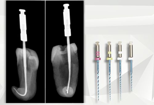 Rotary dental file - croot0003 - C-Root Dental Medical - for root canal ...