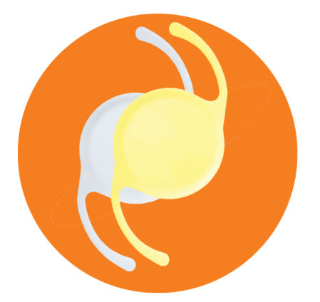 Multifocal intraocular lens - Nanex™ - HOYA Medical Singapore