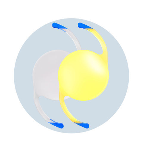 Monofocal intraocular lens - iSert® - HOYA Medical Singapore - PMMA