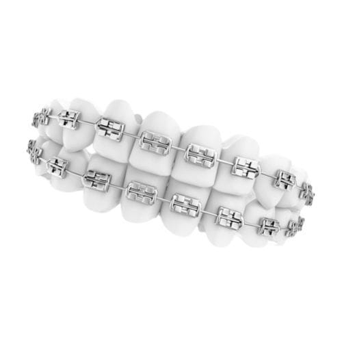 Metal orthodontic bracket - ALA-BS - Alamere Medical Corporation ...