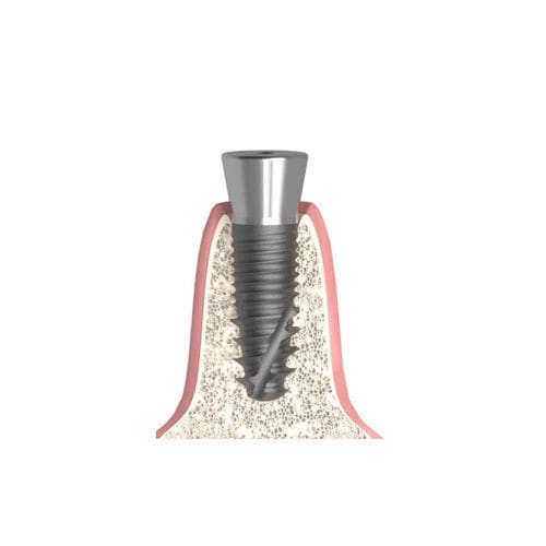 Cylindro-conical healing abutment - Actival - Bionika Medline Kft ...