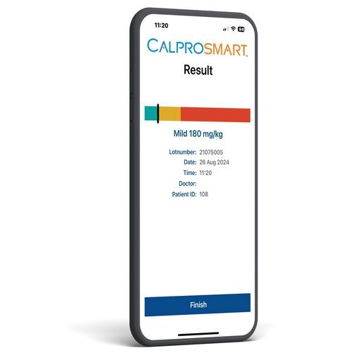 Inflammatory bowel disease POC reader - CalproSmart Office - Calpro AS ...