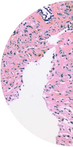 Bladder cancer test kit - UROCAN™ - Geneseeq - for kidney cancer ...