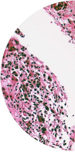 CNS tumor test kit - NEUROCAN™ - Geneseeq - oncology / for precision ...