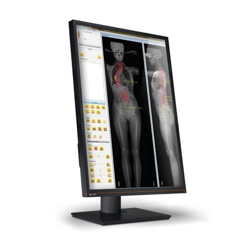 Modeling software - EOS IMAGING - treatment / planning / medical