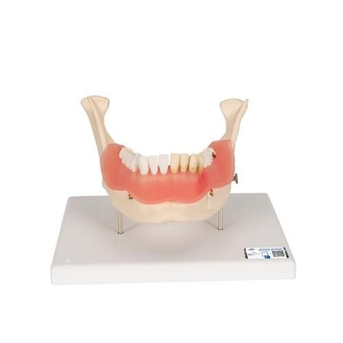 Jaw anatomical model - D26 - 3B Scientific - teeth / for teaching
