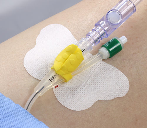 Urinary drainage catheter band - Wing Grip Foley - ACE Medical - leg ...