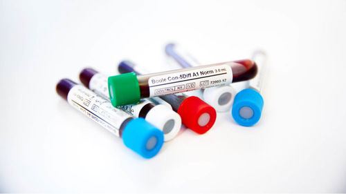 Solution reagent - 150 series - Boule Medical - quality control ...