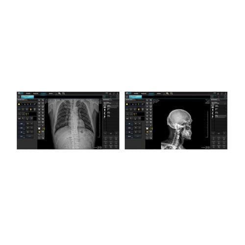 DICOM viewing software - DRGEM - printing / radiology