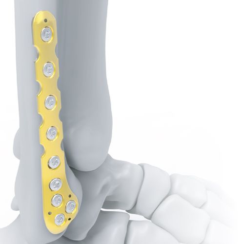 Fibula compression plate - ARIX 3.5 - Jeil Medical Corporation - distal ...