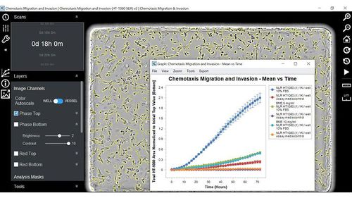 Image analysis software module - Incucyte® - Sartorius Group - capture ...