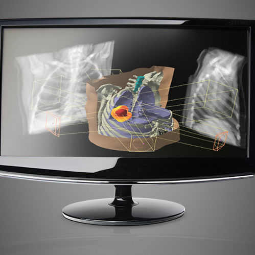 Treatment planning software - Eclipse™ - Varian Oncology - for control ...