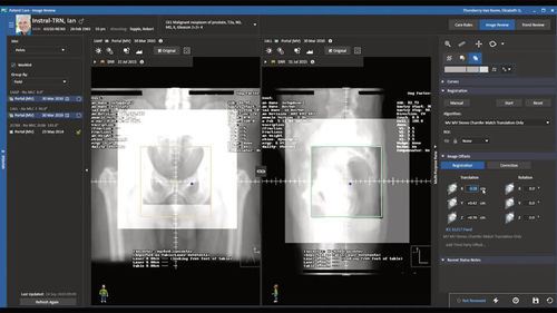 Training software - MOSAIQ® 3 - Elekta - image analysis / medical ...
