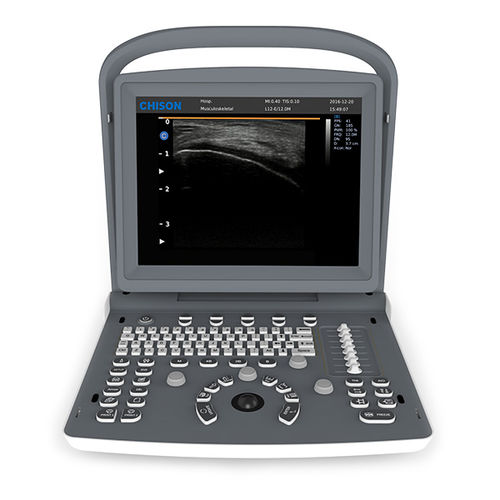 Portable ultrasound system - ECO 2 - CHISON Medical Technologies - for ...