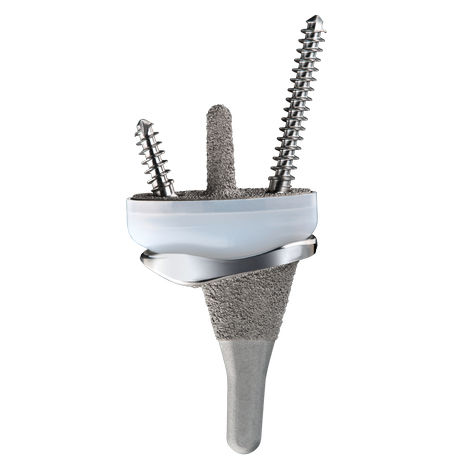 Cemented wrist prosthesis - FREEDOM - Smith & Nephew