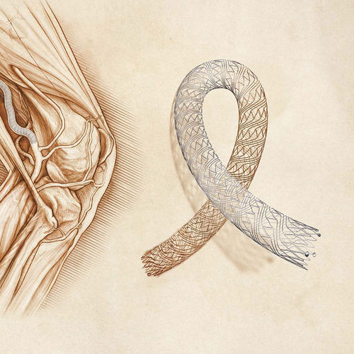 Peripheral stent - S.M.A.R.T™ Flex - Cordis - nitinol / self-expanding
