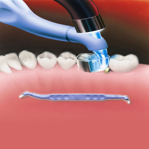 Dental polymerizer - Trimax™ - AdDent, Inc.