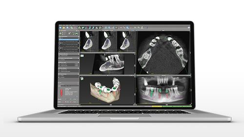 Planning software - coDiagnostiX - Dental Wings - design / for dental ...