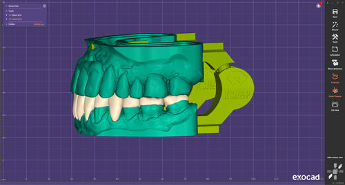 Exocad Wiki Model Creator Module Exocad