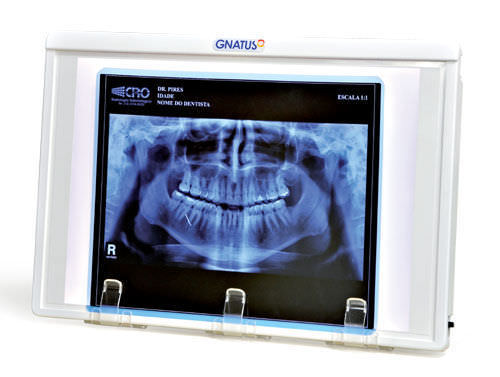 1-screen X-ray film viewer - Gnatus - with switch / dental / white light