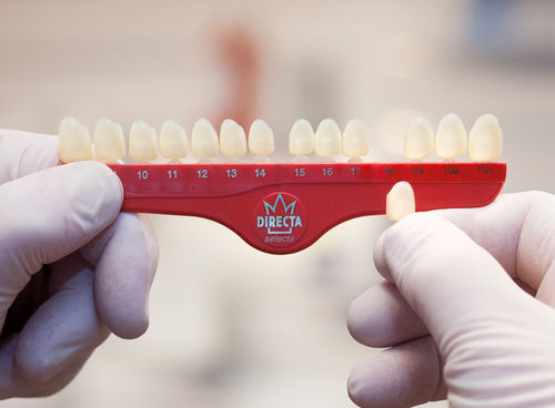 Polycarbonate dental crown - Directa - DIRECTA AB - molar / translucent