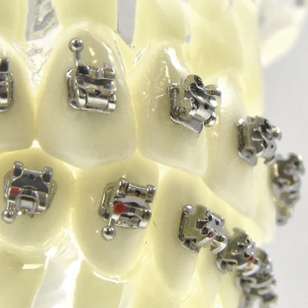 Self-ligating orthodontic bracket - InterActive SL - LEONE S.p.a. - low ...