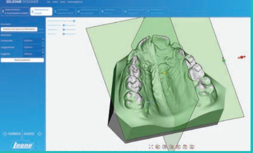 Design software - LEONE S.p.a. - CAD / CAM / for dental laboratories
