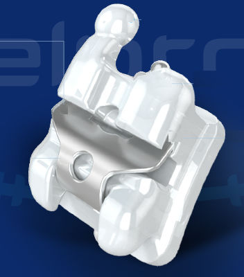 Self-ligating orthodontic bracket - SELPRO A - WORLD BIO TECH - ceramic / round / narrow