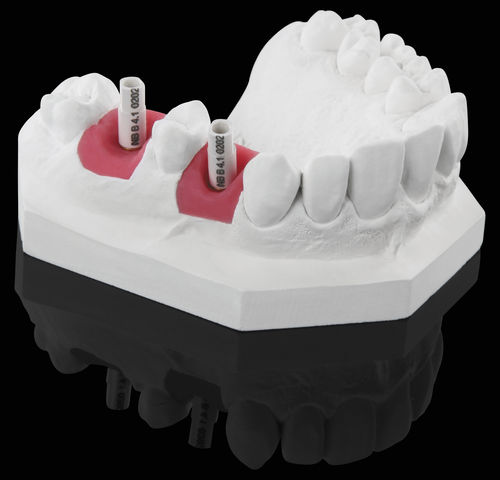 White scanbody - White Scanmarker - Zirkonzahn - intraoral