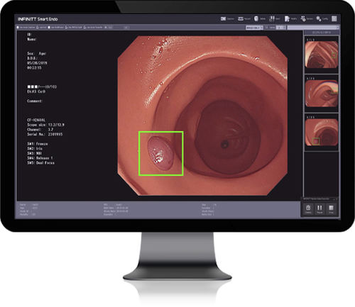 Image analysis software - Smart Endo - Infinitt Healthcare - diagnostic ...