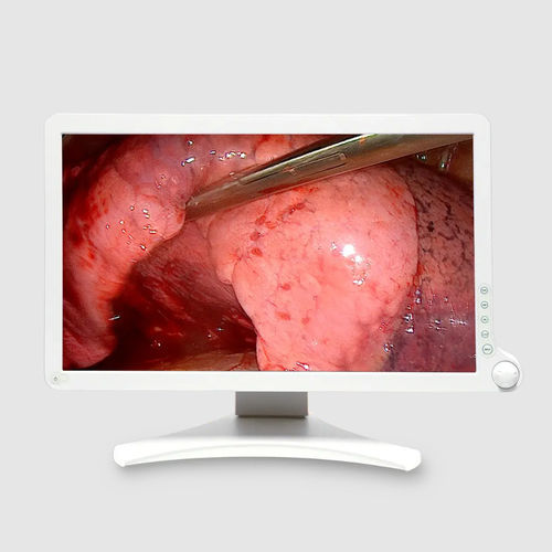 Surgical display - AMM 215WTD - Barco - endoscopy / HD / VGA