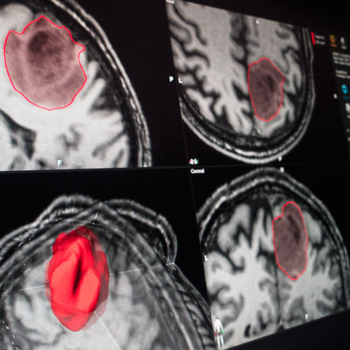 Visualization software - Brainlab - planning / treatment / contour ...