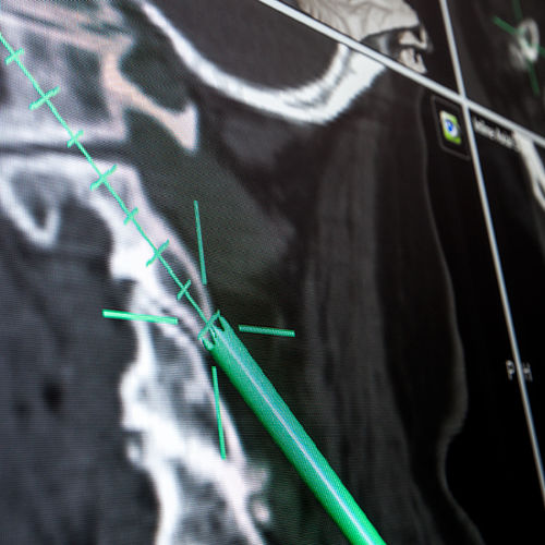 Surgical navigation software - Brainlab - planning / medical / hospital