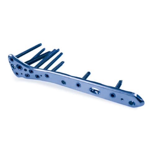 Femur compression plate - 3.40 series - ChM - femoral condyle / distal ...