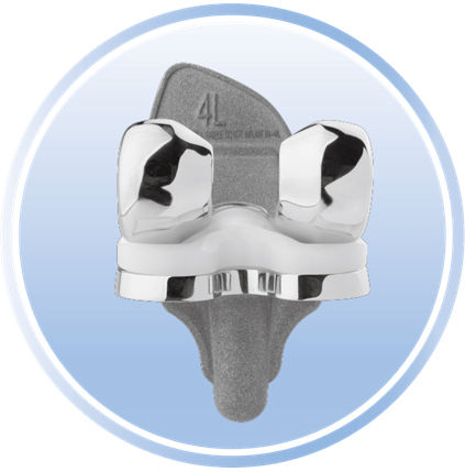 Total knee prosthesis - XN-CR - Beijing Chunli Technology Development ...