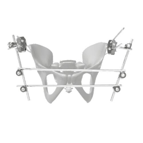 Pelvis external fixation system - 206306 - SOFEMED International ...