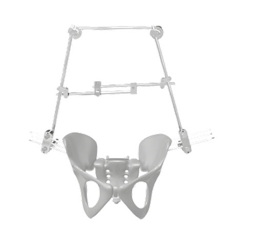 Pelvis external fixation system - 201561 - SOFEMED International ...
