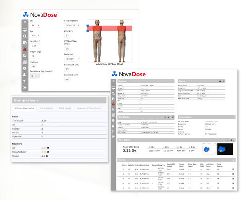 Radiation dose management software - NovaDose® - Novarad - management ...
