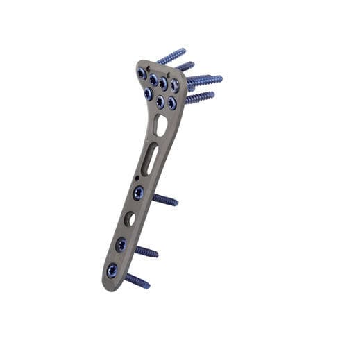 Radius compression plate - Vortex - Sanatmetal - distal / locking ...