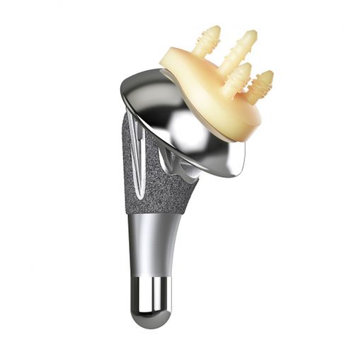 Cementless shoulder prosthesis - AltiVate® - Enovis Surgical