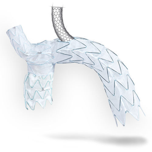 Aortic arch stent graft - NEXUS DUO™ - Artivion - nitinol / ePTFE
