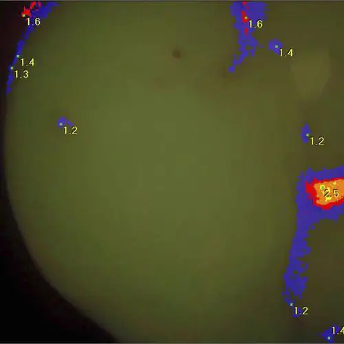 Laser Fluorescence Caries Detector Camx Spectra Air CamX Spectra
