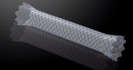 Colonic stent - HANAROSTENT®TTS (CCC) - M.I Tech - rectal