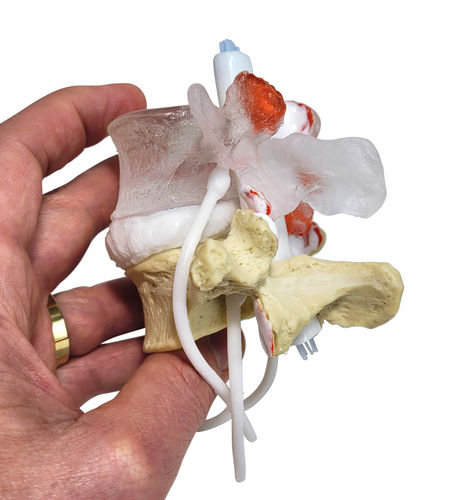 Lumbar vertebra anatomical model - Professional LxH - Dynamic Disc ...