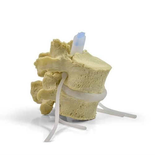 Bone model - Dynamic Disc Designs Corp. - lumbar vertebra ...